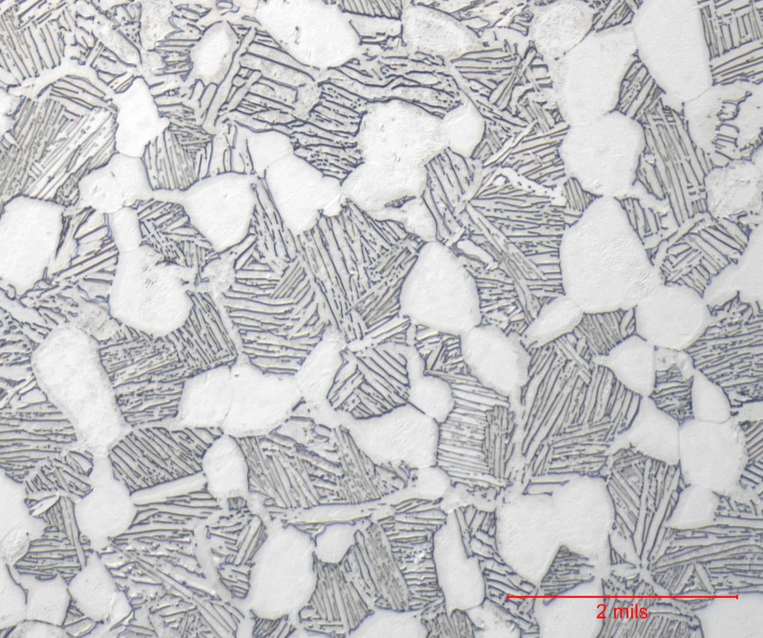 Alpha Beta Titanium Alloy (Ti-6Al-4V) *Update* - Metallography with Neel